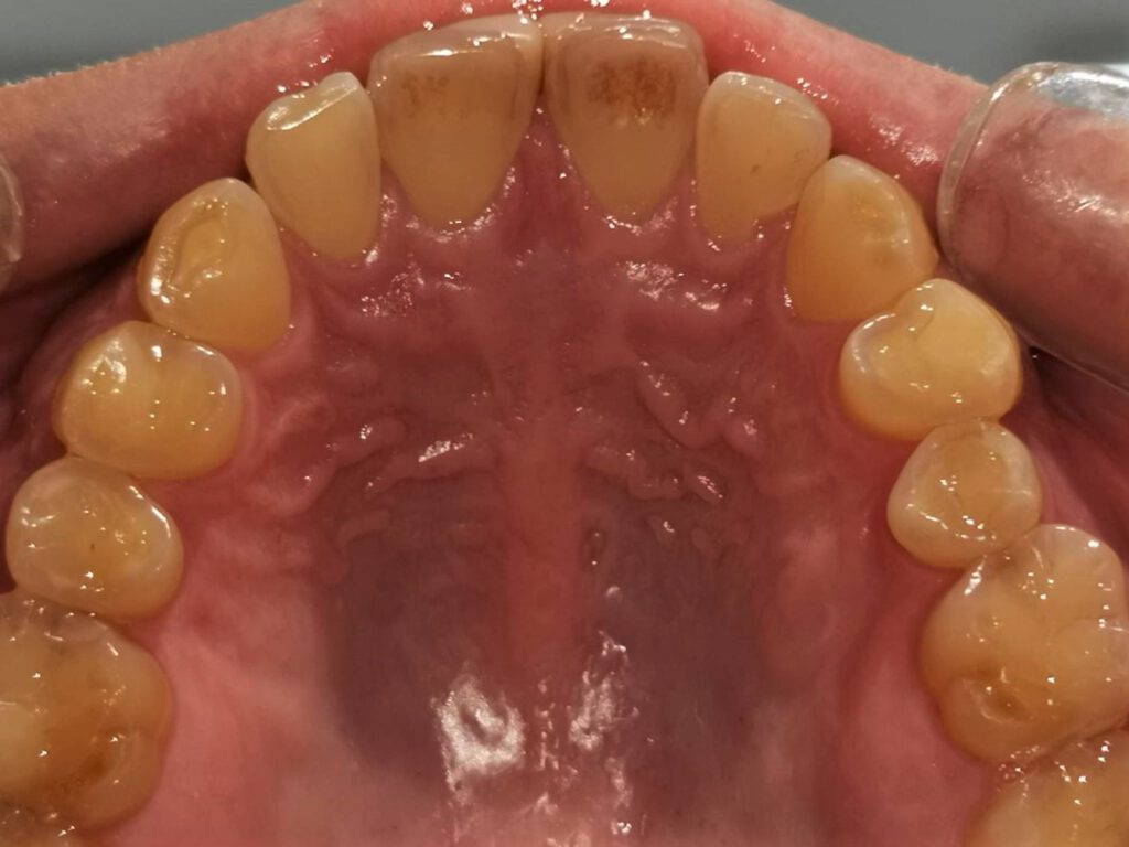 Cleaning Airflow – AU Dental